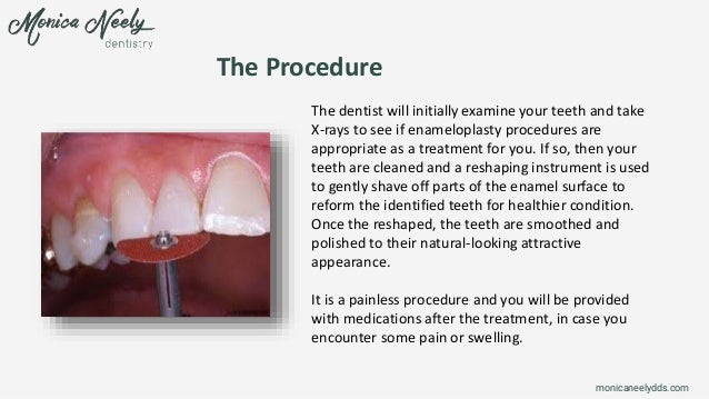 What Is An Enameloplasty?