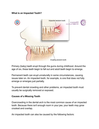 What is an impacted tooth and causes of a missing tooth (1) | PDF ...