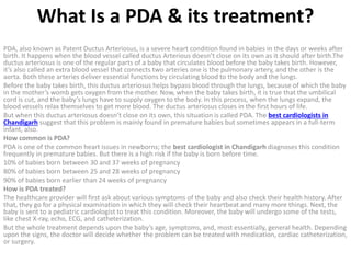 What Is a PDA & its treatment.pptx
