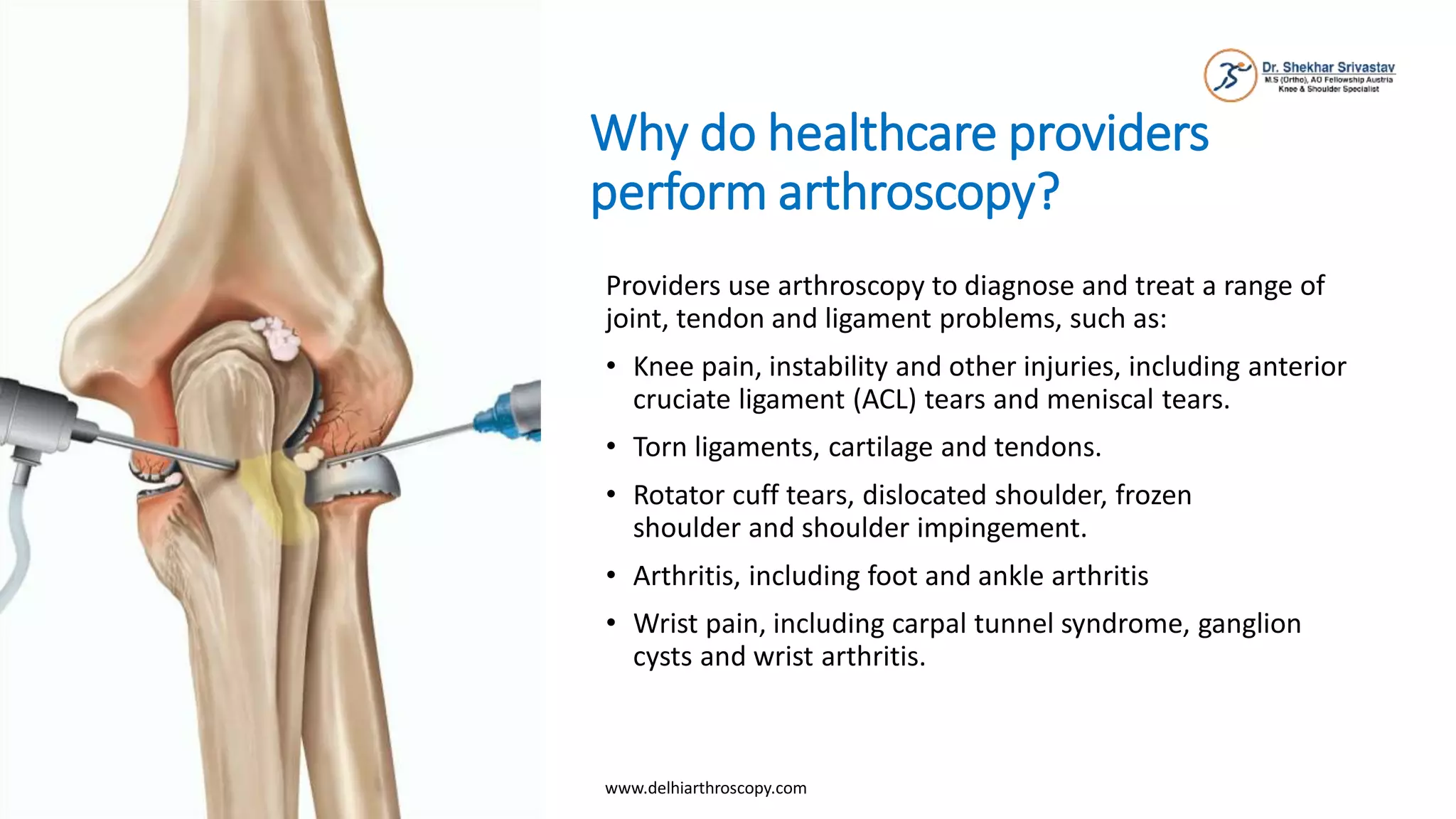 What is arthroscopy | PDF