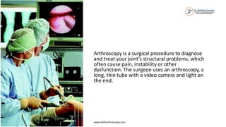 What is arthroscopy | PDF