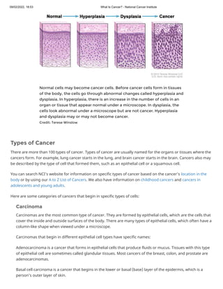 What is cancer national cancer institute | PDF | Cancer | Diseases and Conditions