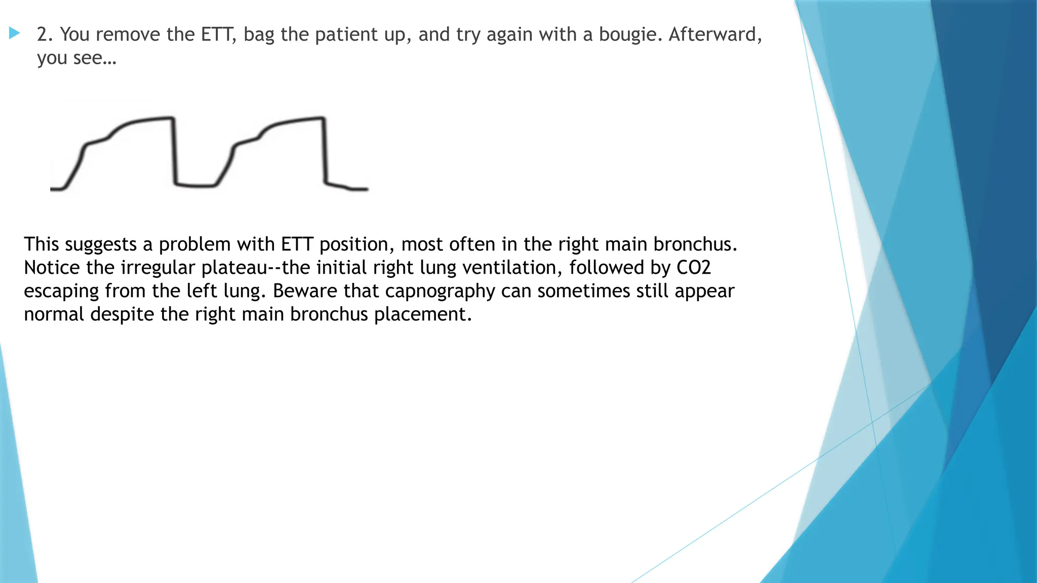 What is Capnography anesthesia point of view | PPTX