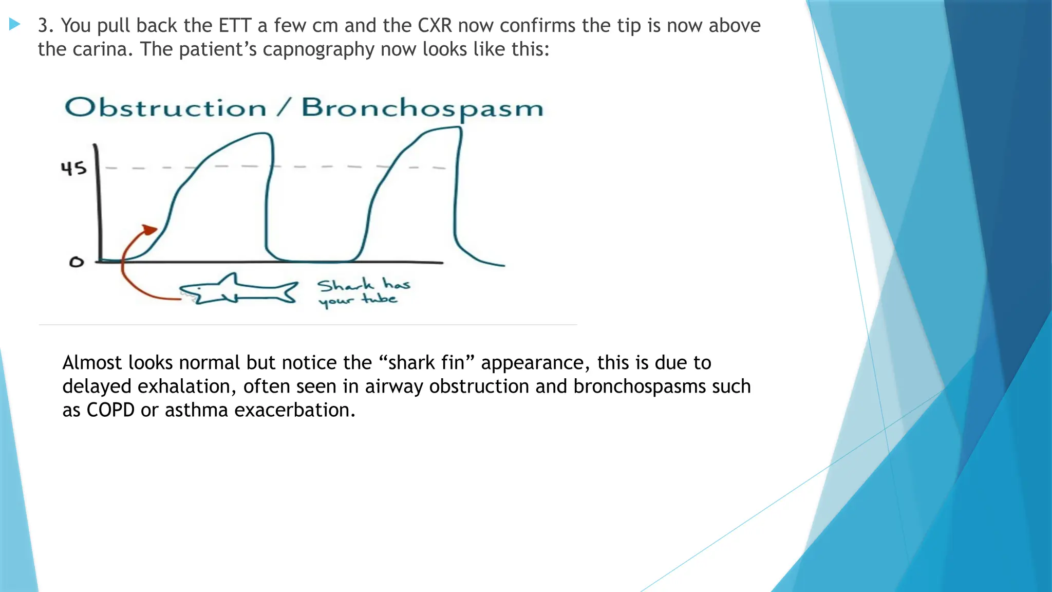 What is Capnography anesthesia point of view | PPTX