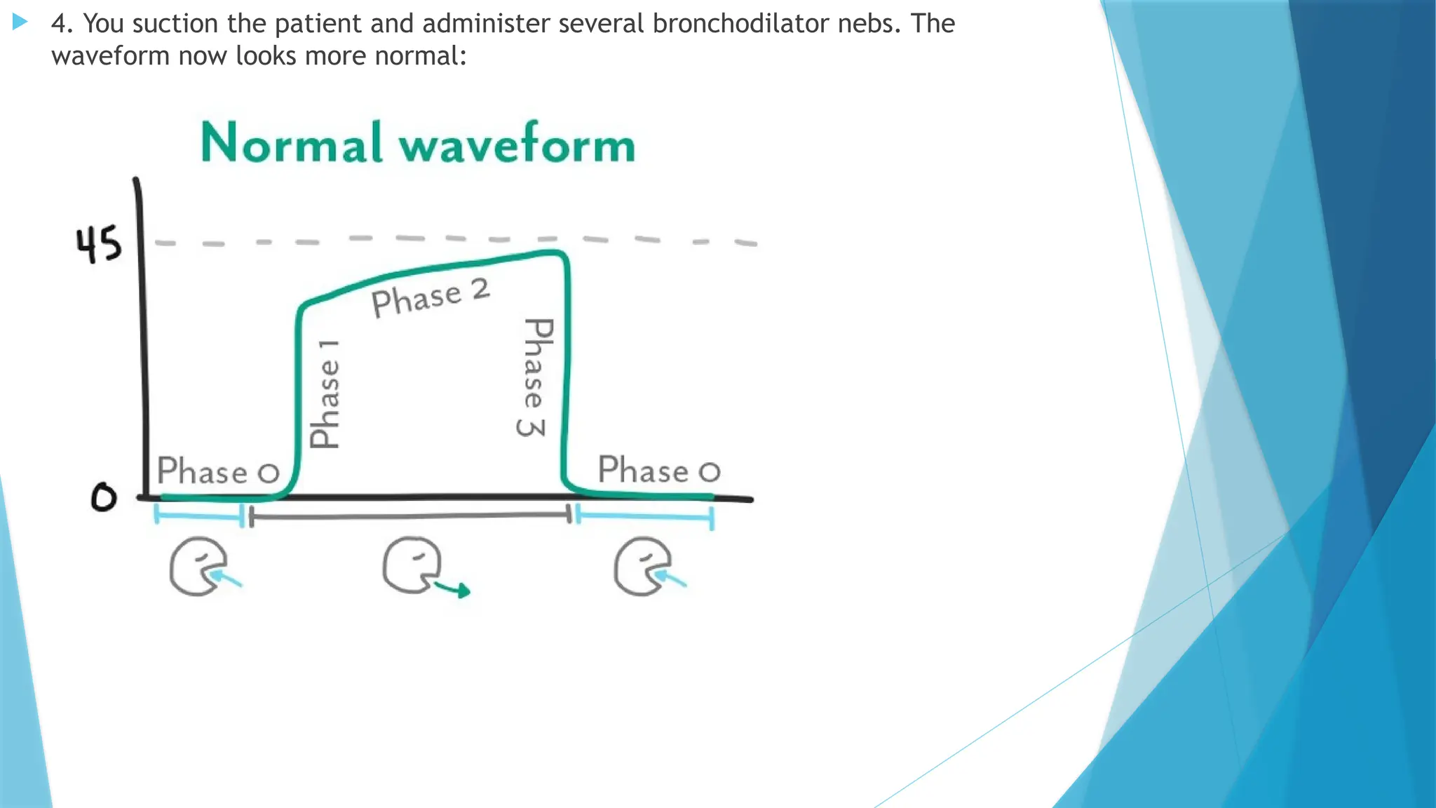 What is Capnography anesthesia point of view | PPTX