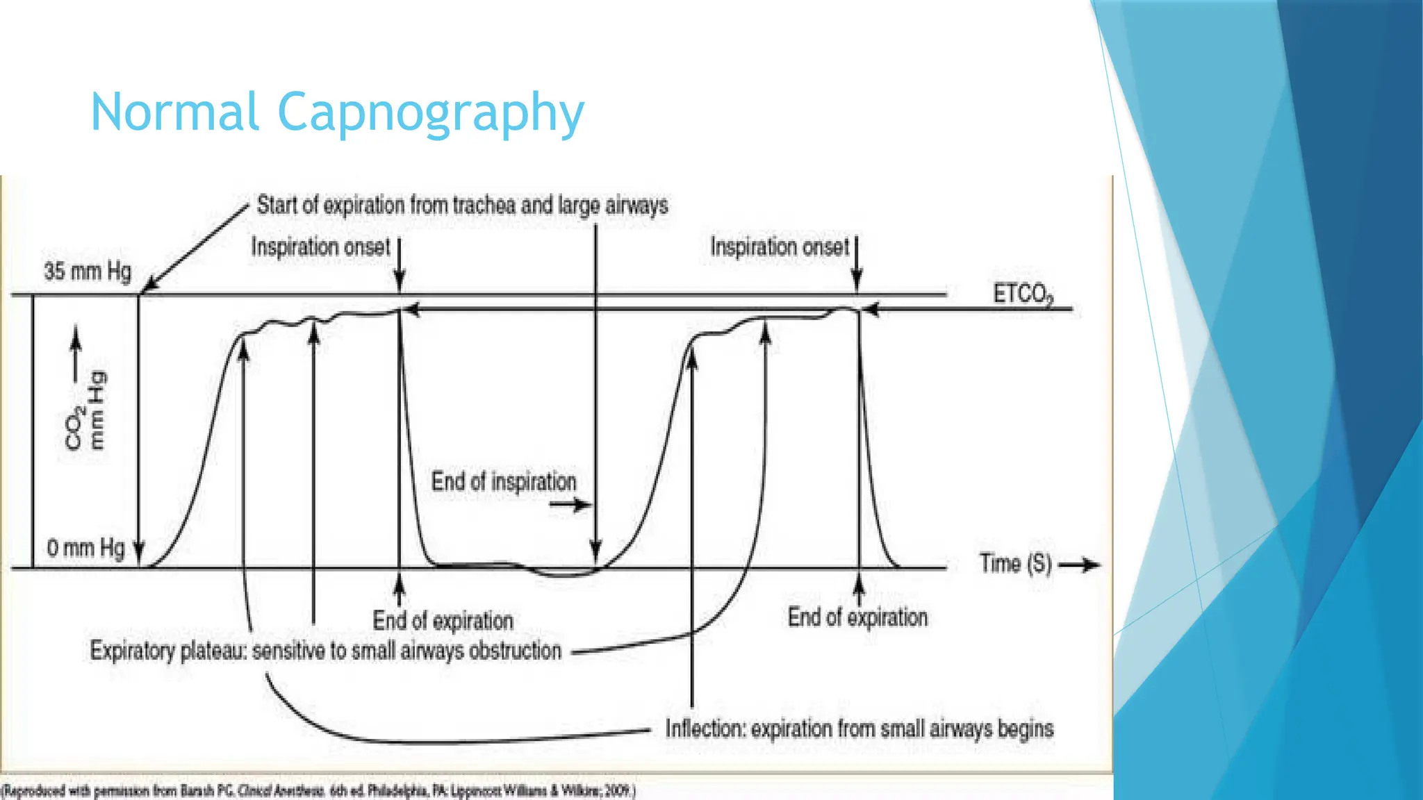 What is Capnography anesthesia point of view | PPTX