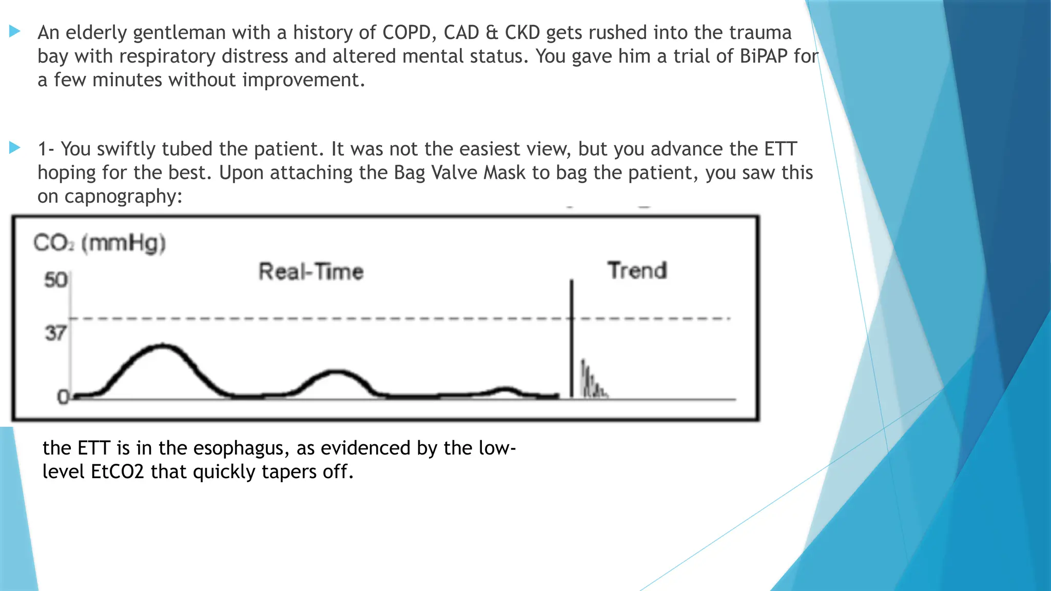 What is Capnography anesthesia point of view | PPTX