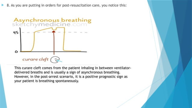 What is Capnography anesthesia point of view | PPT