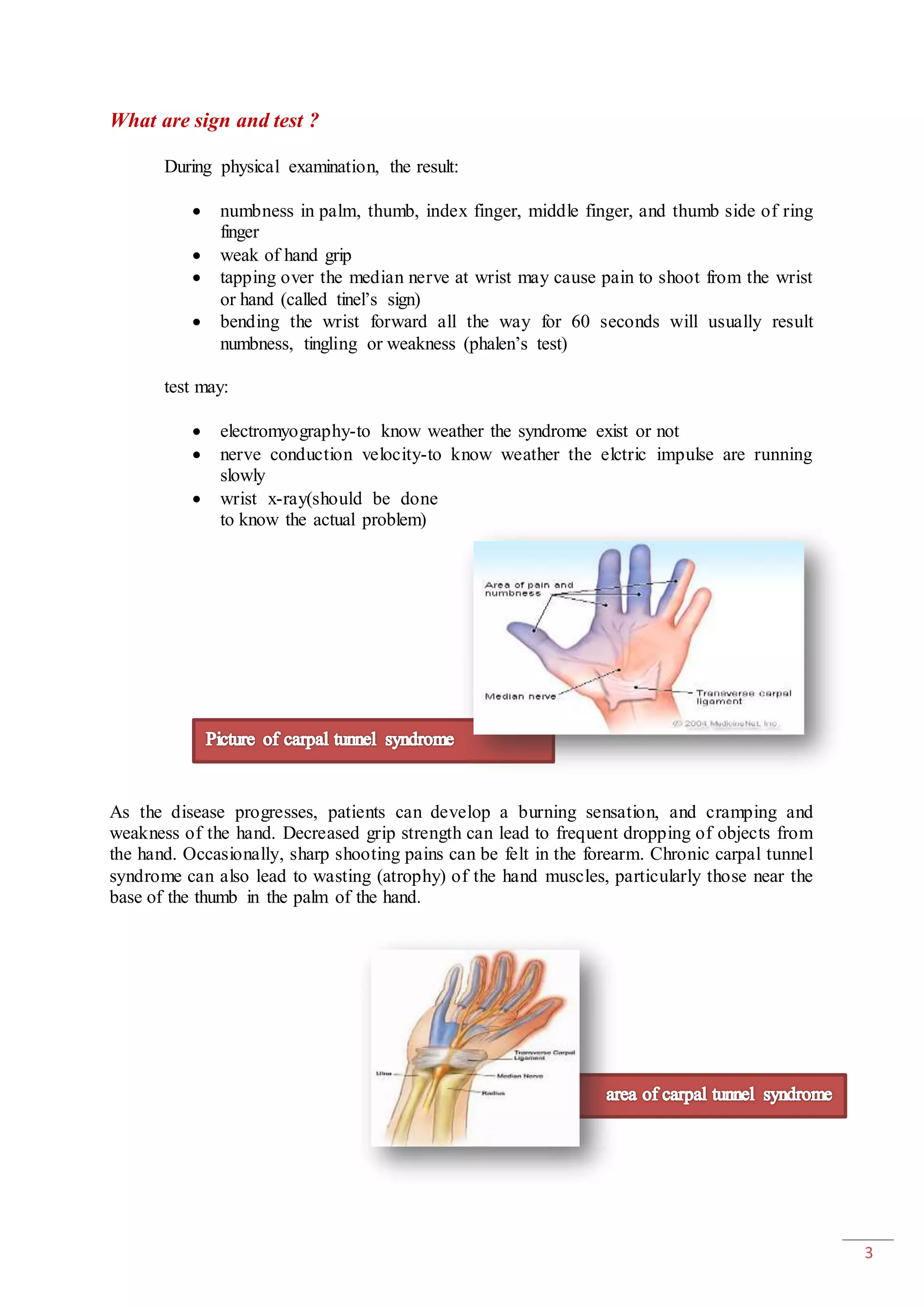 What is carpal tunnel syndrome | DOCX