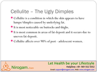 What is cellulite, what causes cellulite, how to get rid of cellulite | PPT