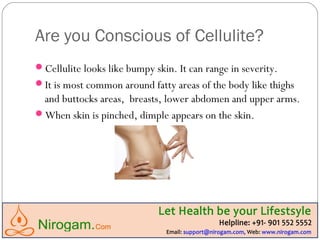 What is cellulite, what causes cellulite, how to get rid of cellulite | PPT