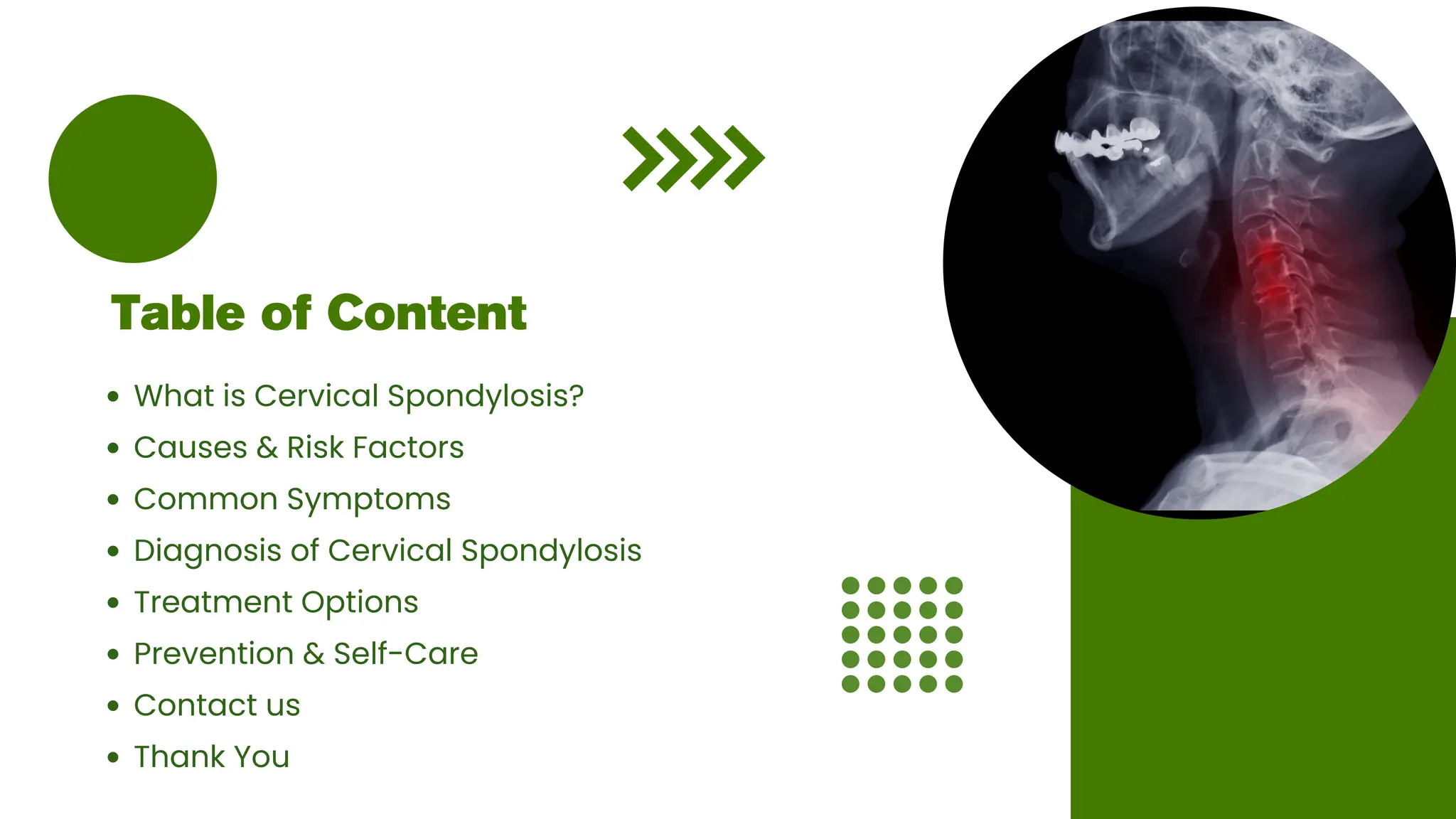 What is Cervical Spondylosis? Complete Guide & Overview | PDF