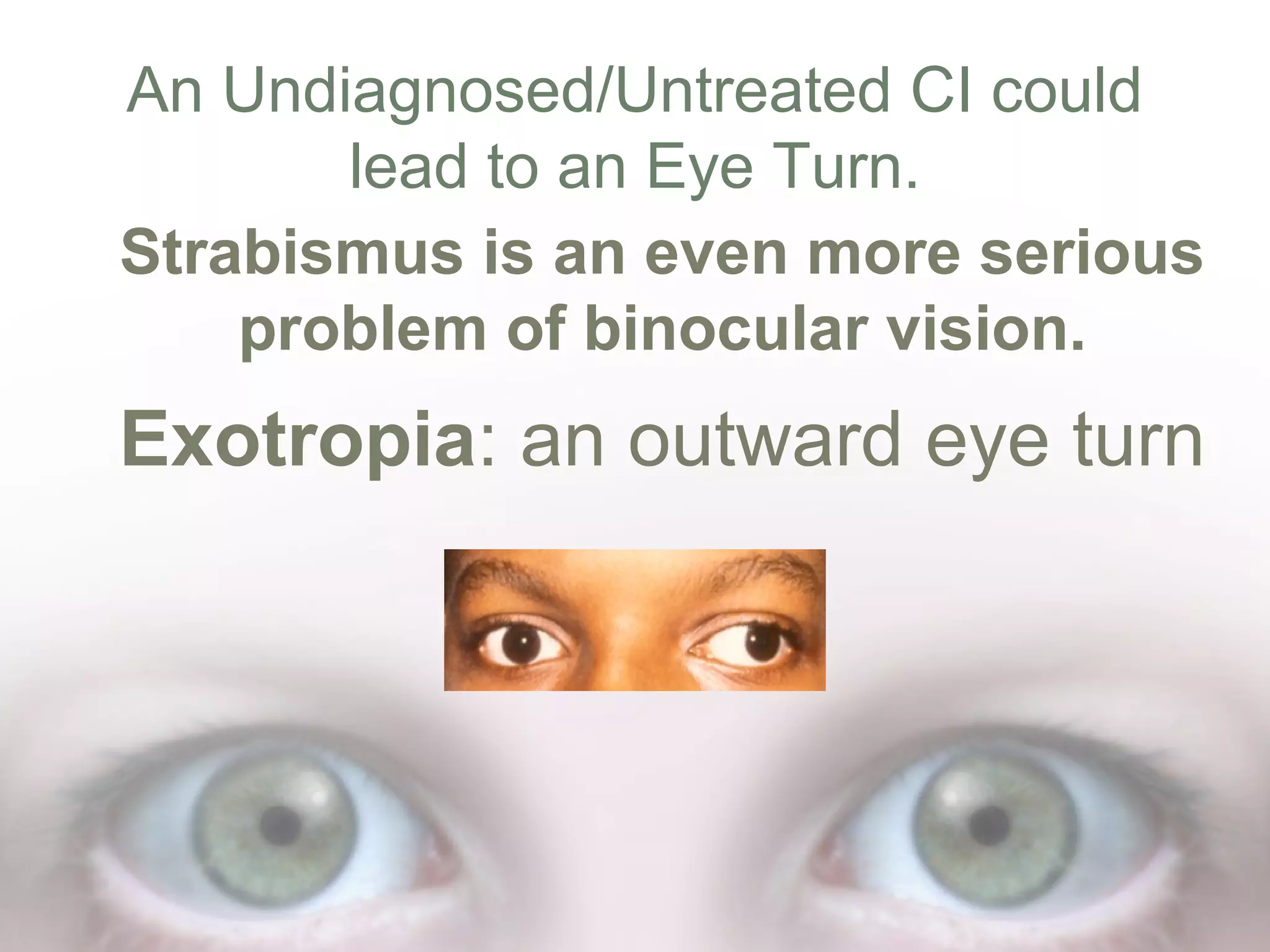 What is Convergence Insufficiency? | PPT