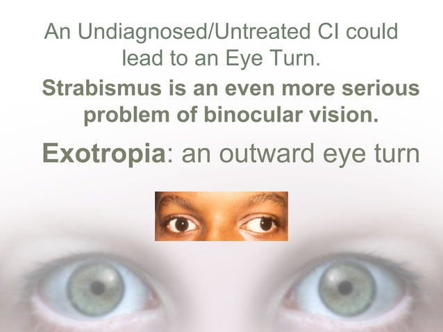 What is Convergence Insufficiency? | PPT | Physical Therapy | Wellness