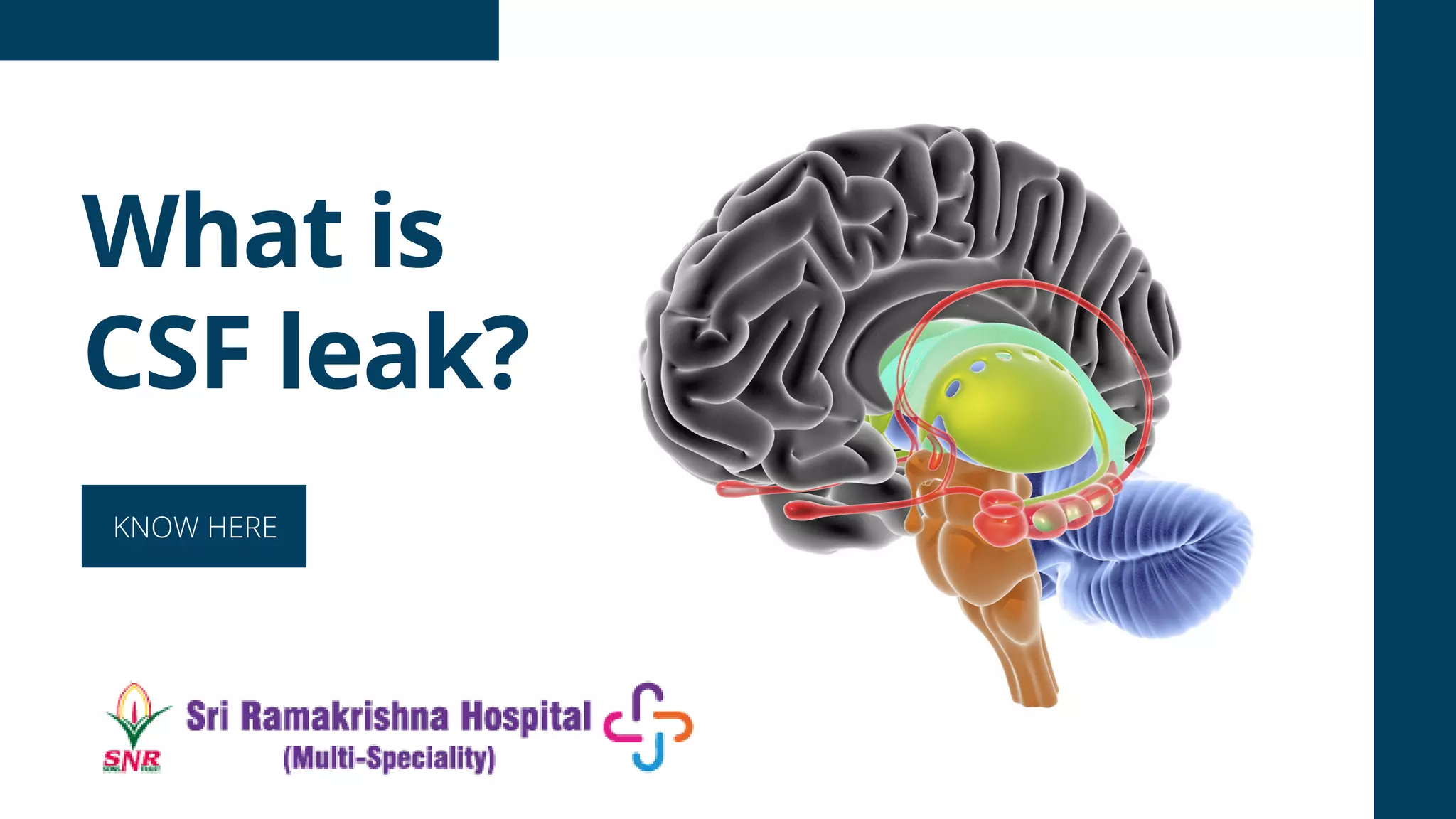 What is CSF leak? | PDF