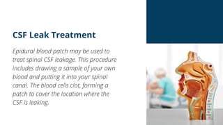 What is CSF leak? | PPT