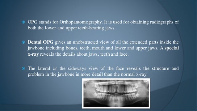 What is dental opg