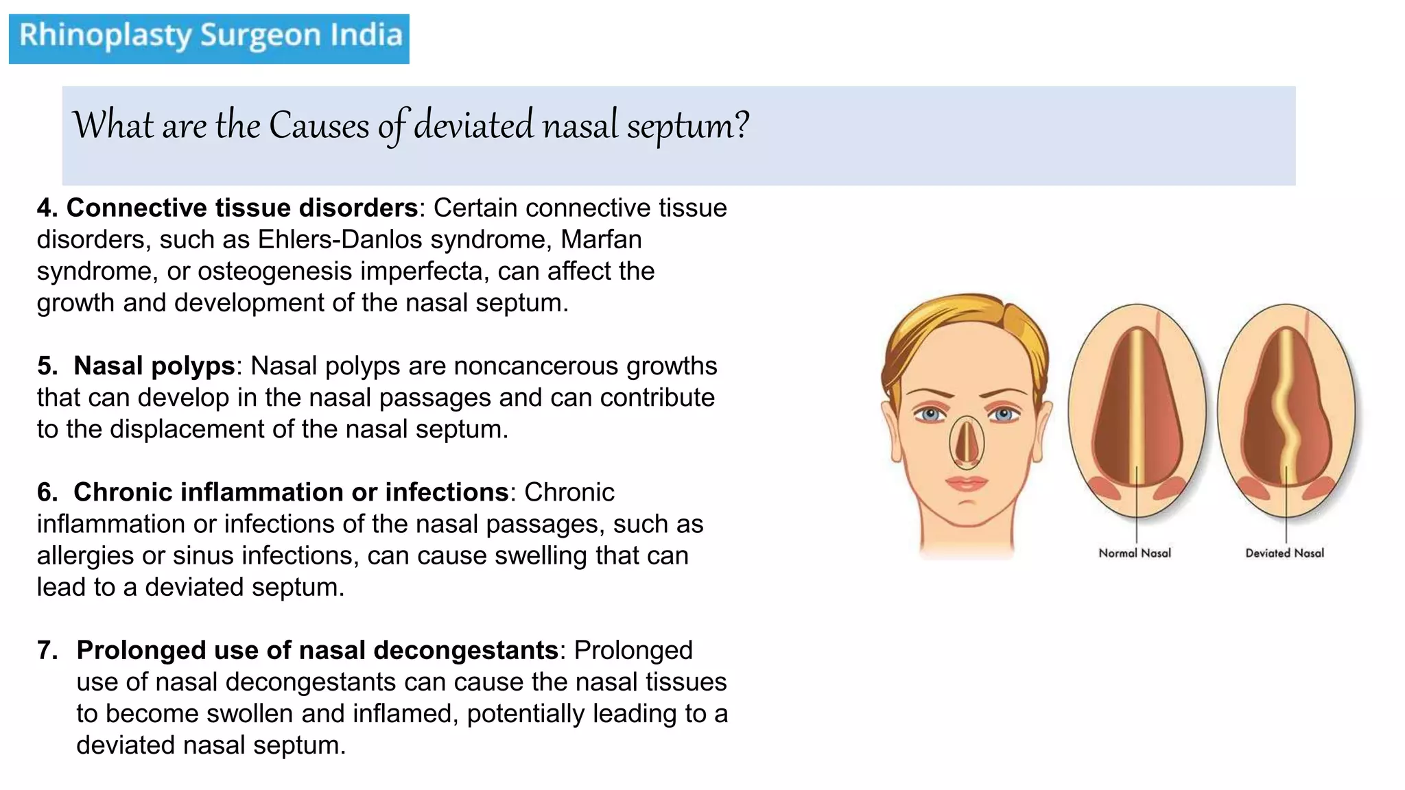 What is Deviated Nasal Septum - PPT.pptx