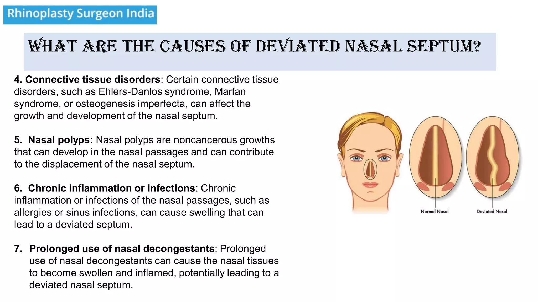 What is Deviated Nasal Septum | PDF