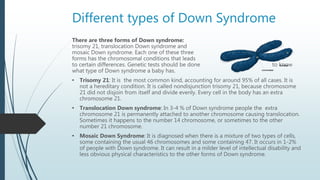 What is down syndrome | PPT