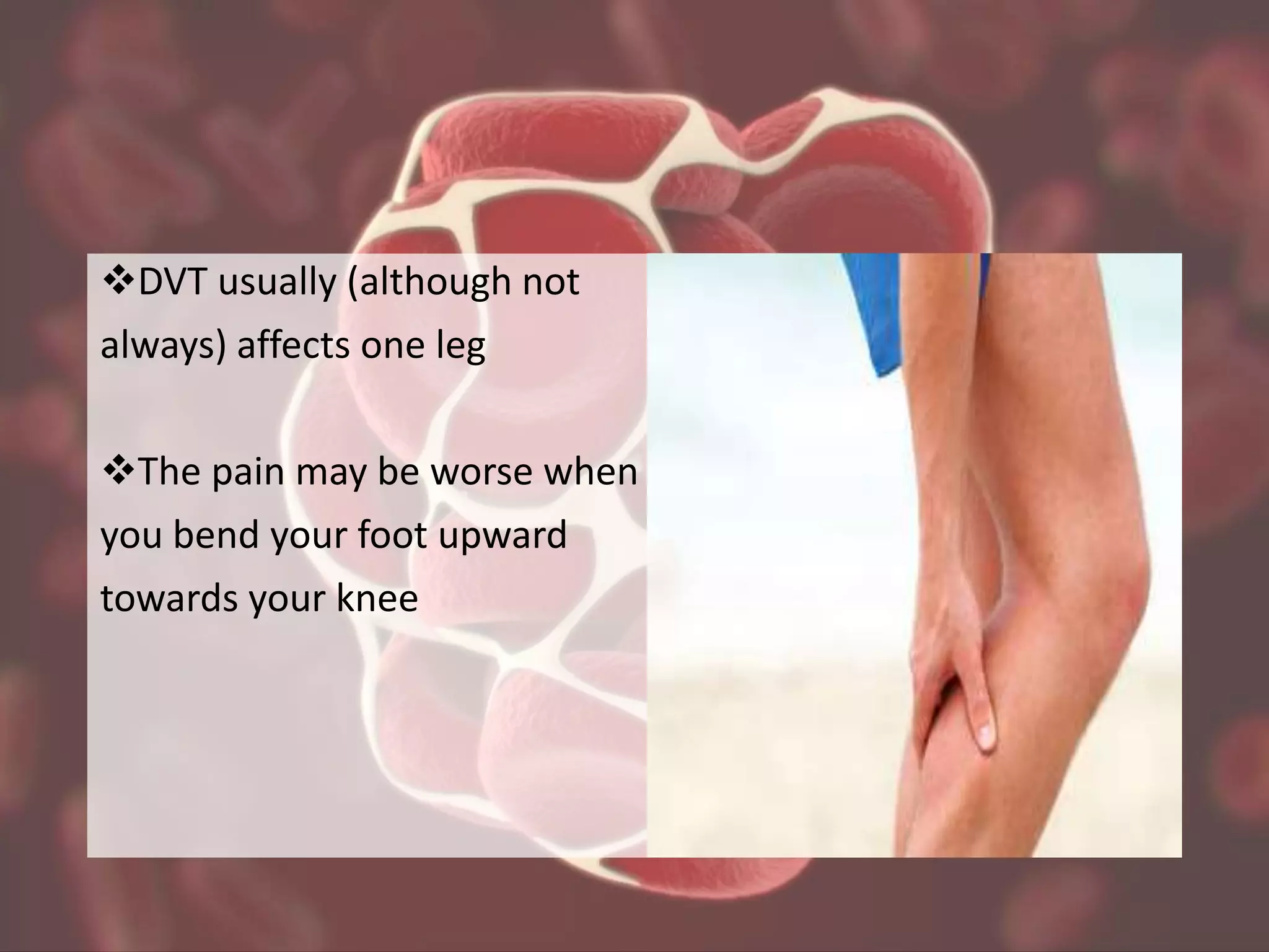What is DVT? | PPTX | Blood Disorders | Diseases and Conditions