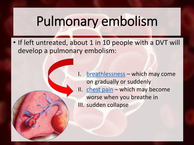 What is DVT? | PPTX | Blood Disorders | Diseases and Conditions