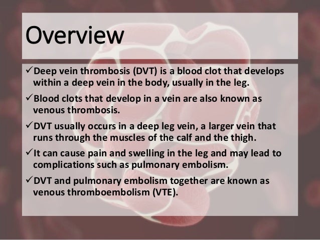 What is DVT?