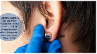 What is Earlobe Repair and How it can be Useful | PPTX