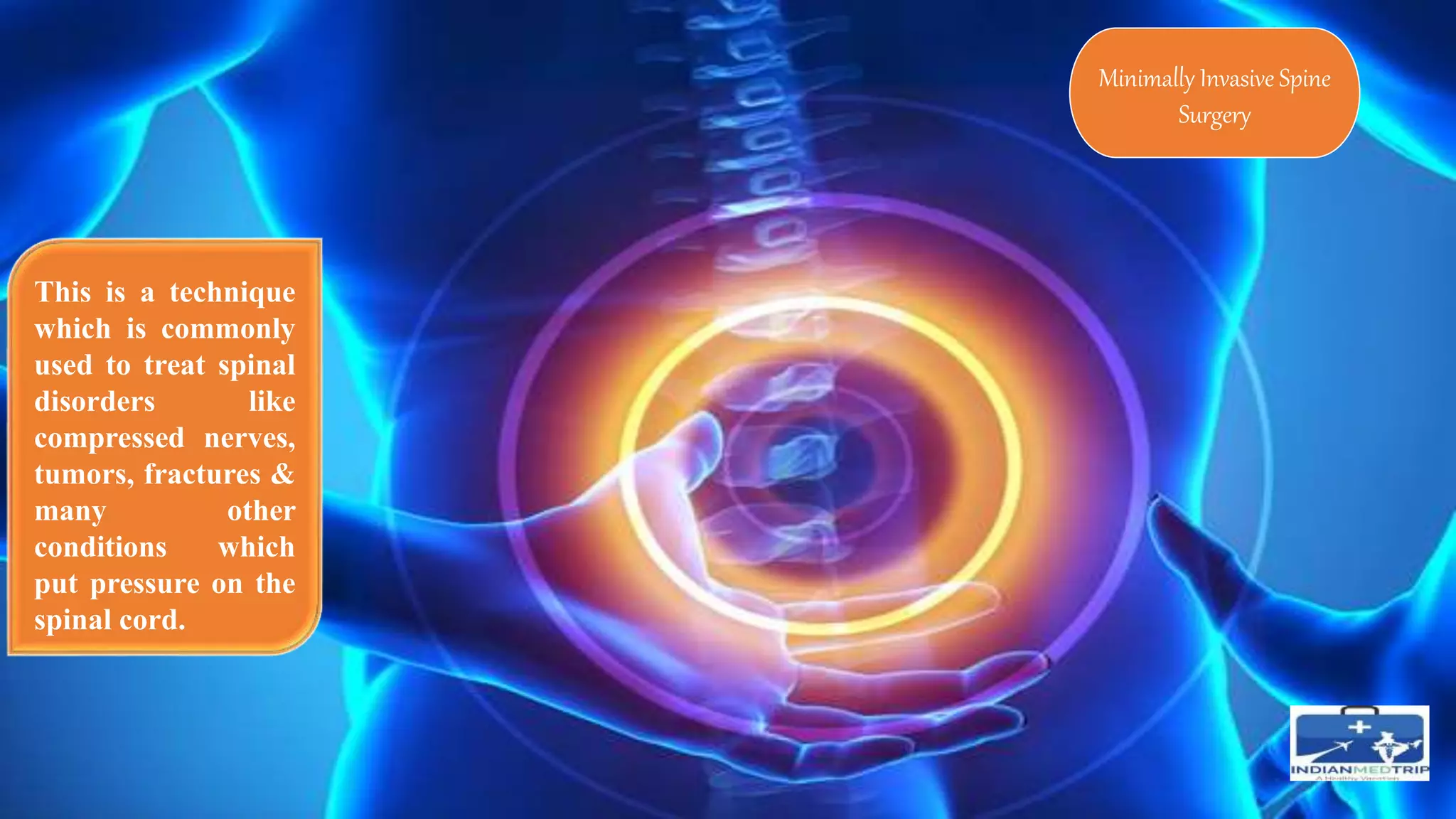 What is Endovascular Neurosurgery | PPTX | Brain and Nervous System ...