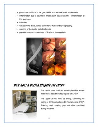 ERCP | PDF