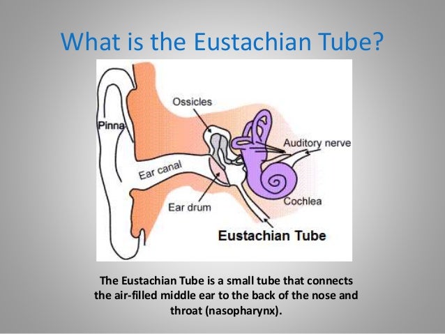 What is eustachian tube dysfunction