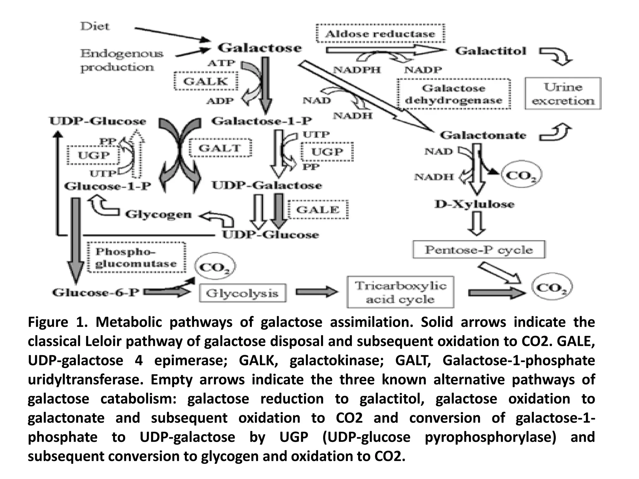 What is galactosemia | PDF | Digestive Disorders | Diseases and Conditions