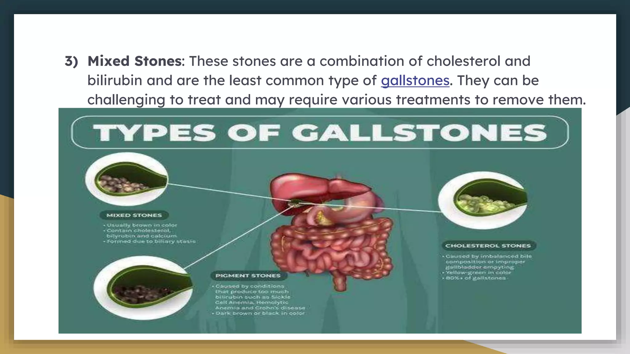What is Gallbladder Stone , Causes and Treatment.pptx
