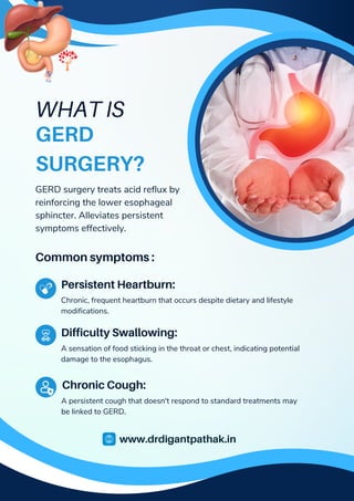 what is GERD surgery.pdf