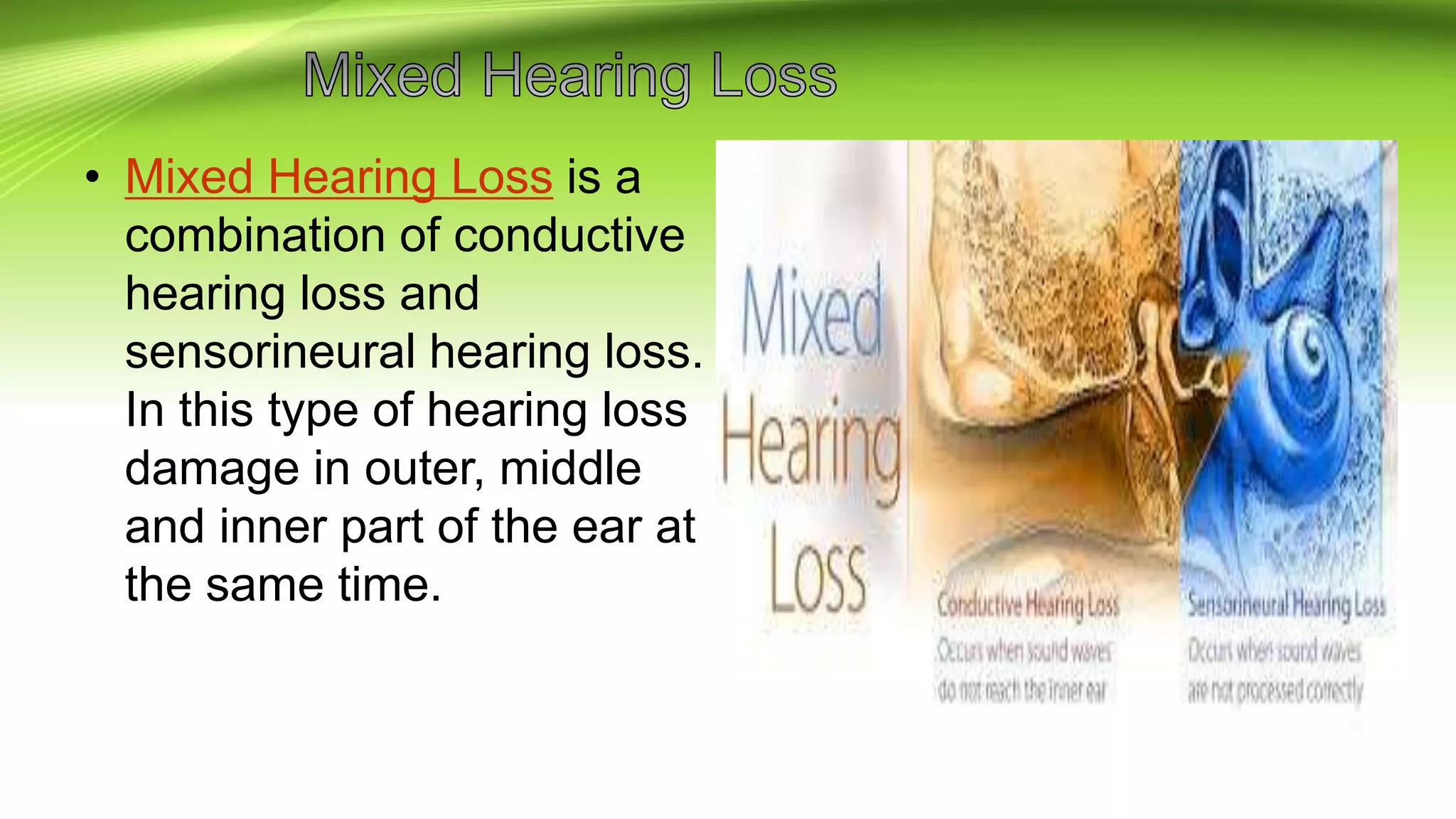 Hearing loss and types of Hearing loss | PPTX
