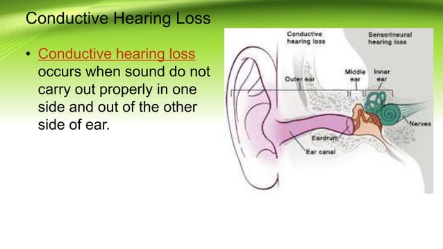 Hearing loss and types of Hearing loss | PPT