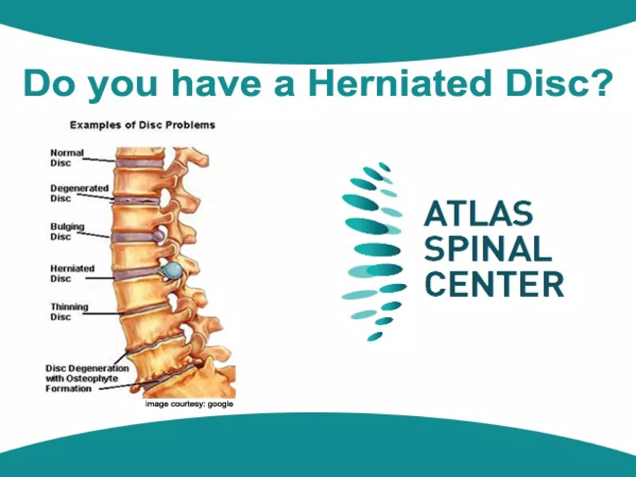 What is herniated disc | PPT