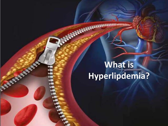 What is hyperlipidemia | PPT