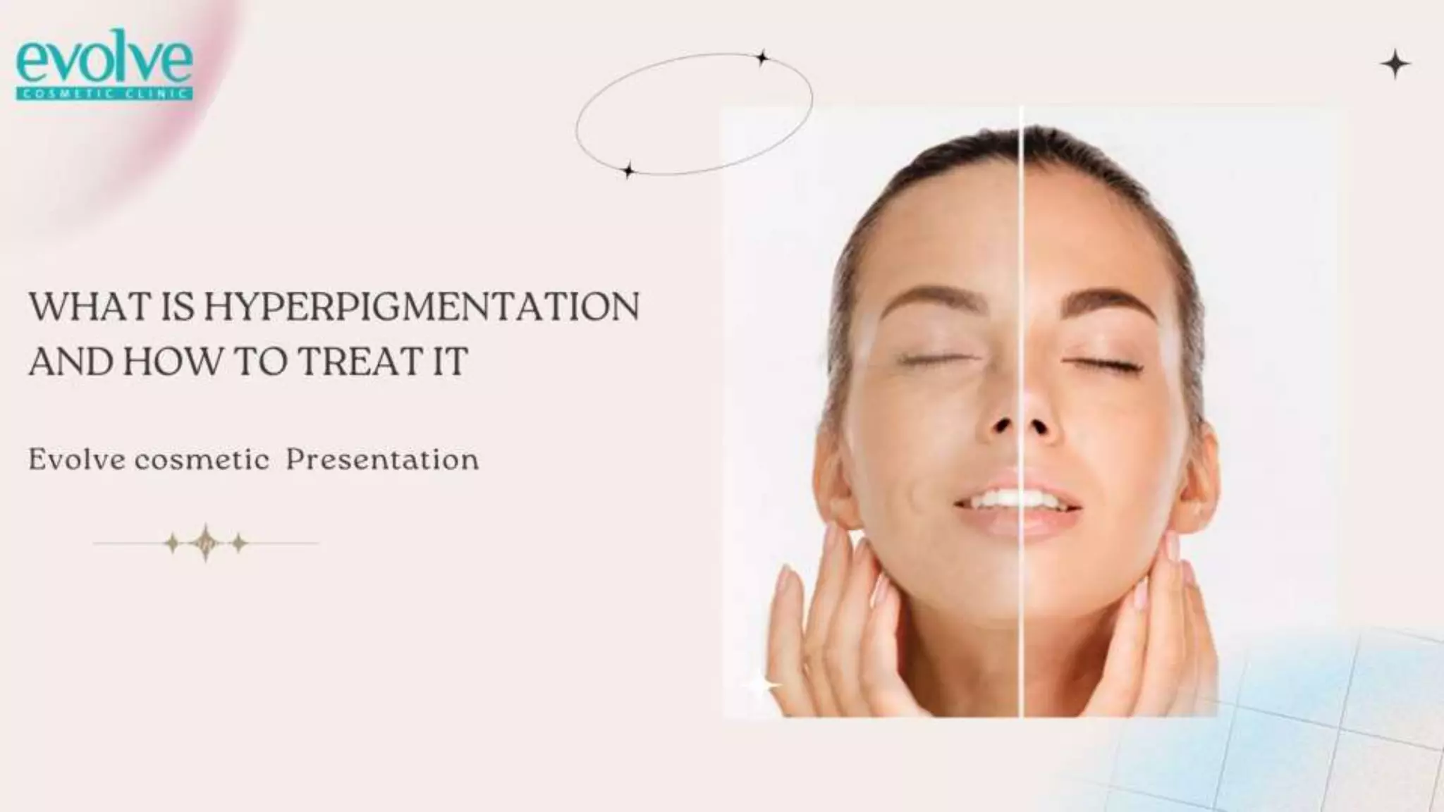What is Hyperpigmentation and How to Treat It | PPTX