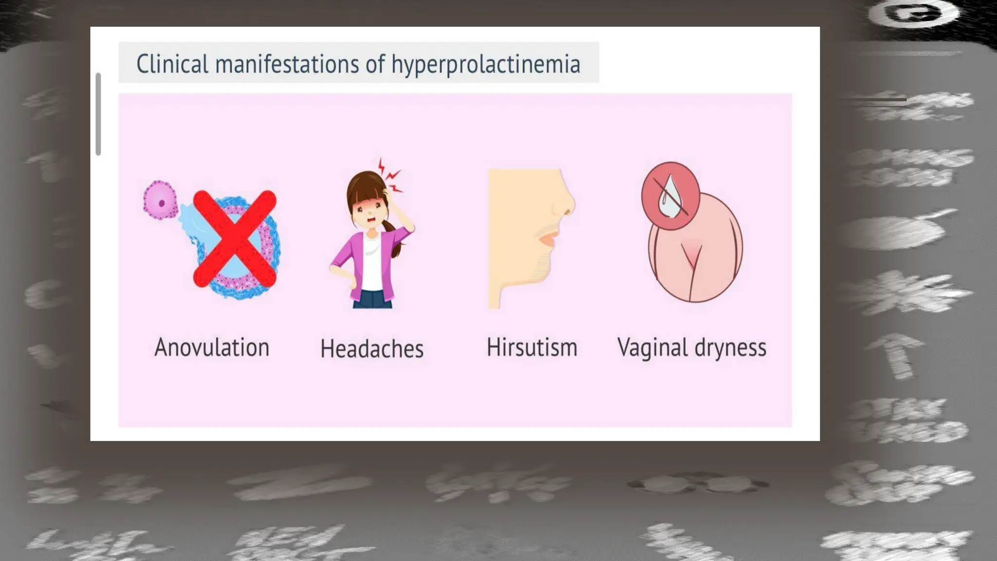 What is hyperprolactinemia? A brief review | PPT