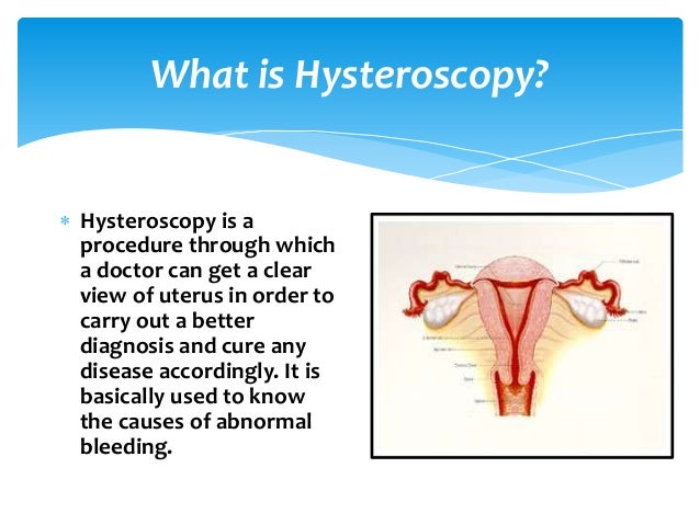 What is Hysteroscopy?