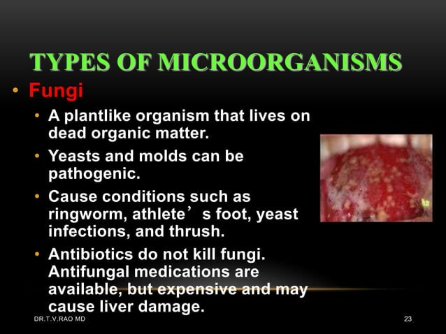 What is Infection ? | PPTX | Infectious Diseases | Diseases and Conditions