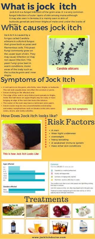 What Is Jock Itch