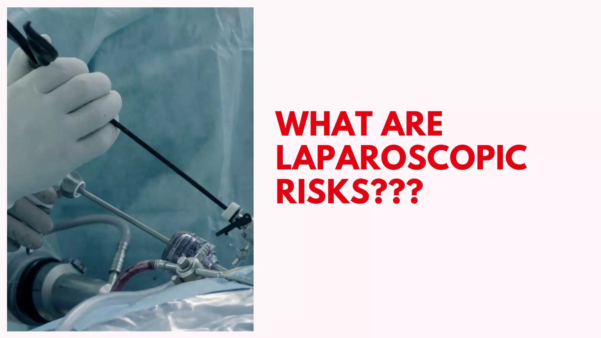 What is Laparoscopy? - An Overview by RG Stone Hospital Ludhiana | PPT