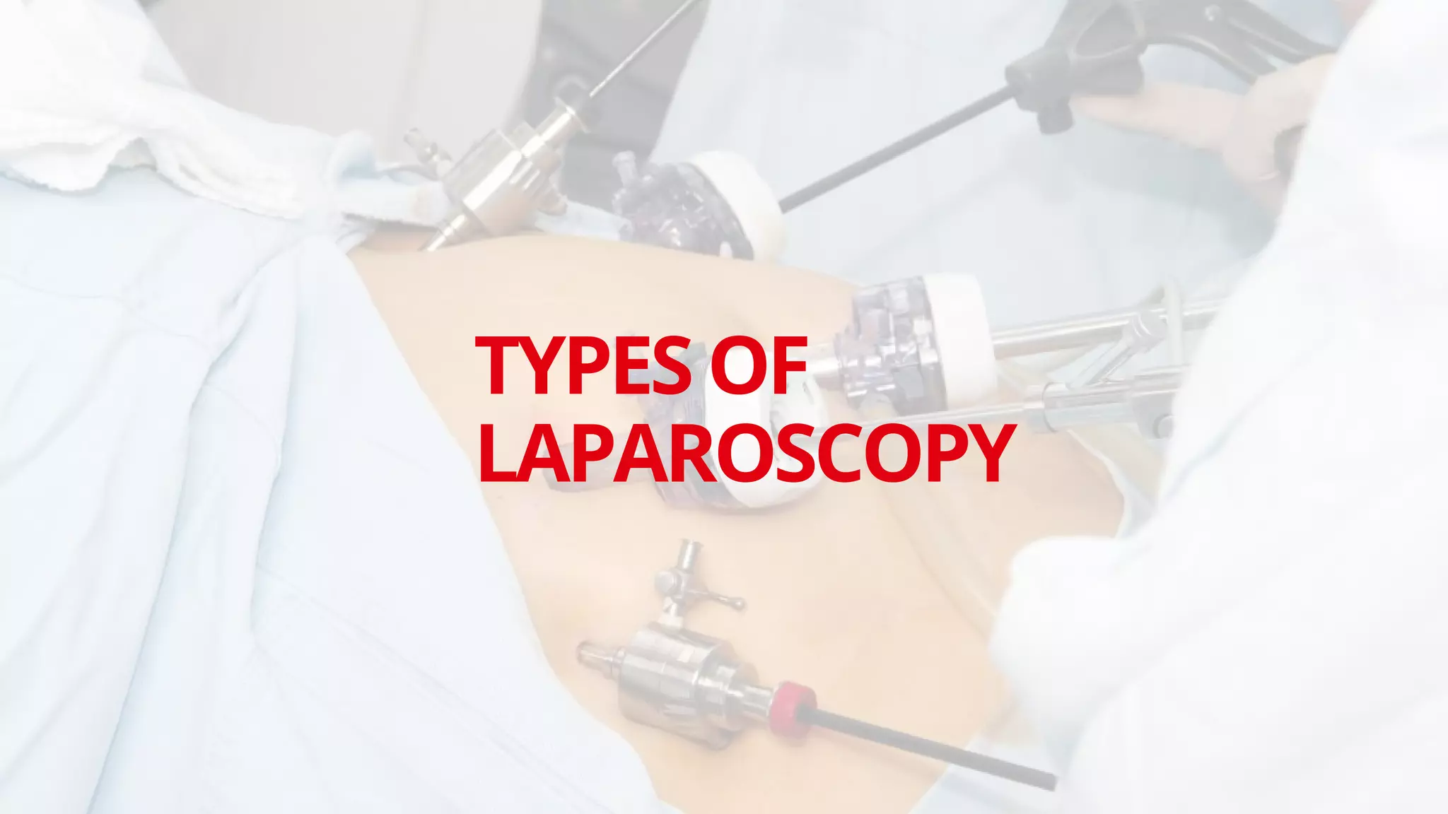 What is Laparoscopy? - An Overview by RG Stone Hospital Ludhiana | PPT