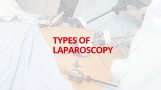 What is Laparoscopy? - An Overview by RG Stone Hospital Ludhiana | PPT