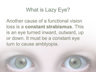 What is lazy eye? | PPT