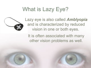 What is lazy eye? | PPT