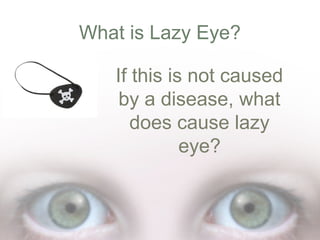 What is lazy eye? | PPT
