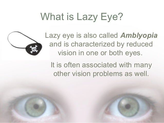 What is lazy eye?